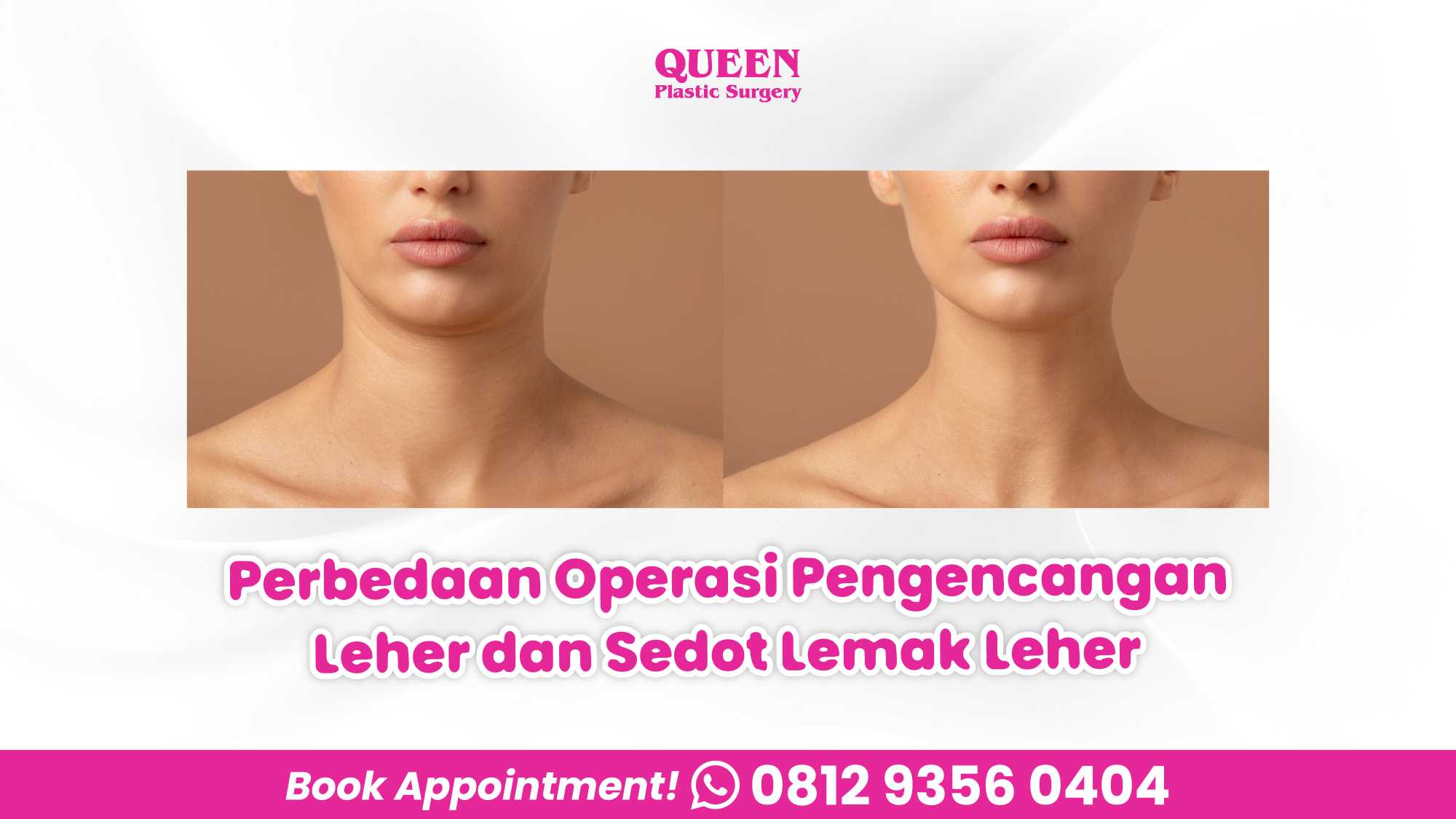 Perbedaan Operasi Pengencangan Leher dan Sedot Lemak Leher - DOKTER ...